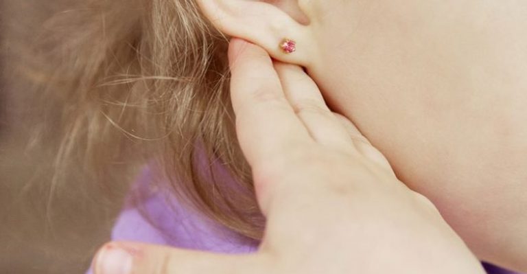What You Need to Know Before You Get Your Ears Pinned - Web Health ...